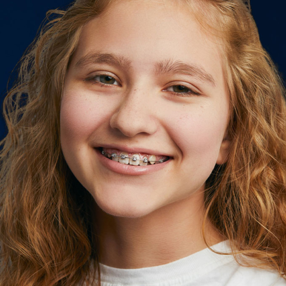 Wheaton Orthodontic Center | Metal and Clear Braces for All Ages